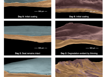 DuraSeal Xact Spinal Sealant System